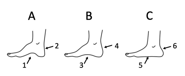 Van Lábproblémája?